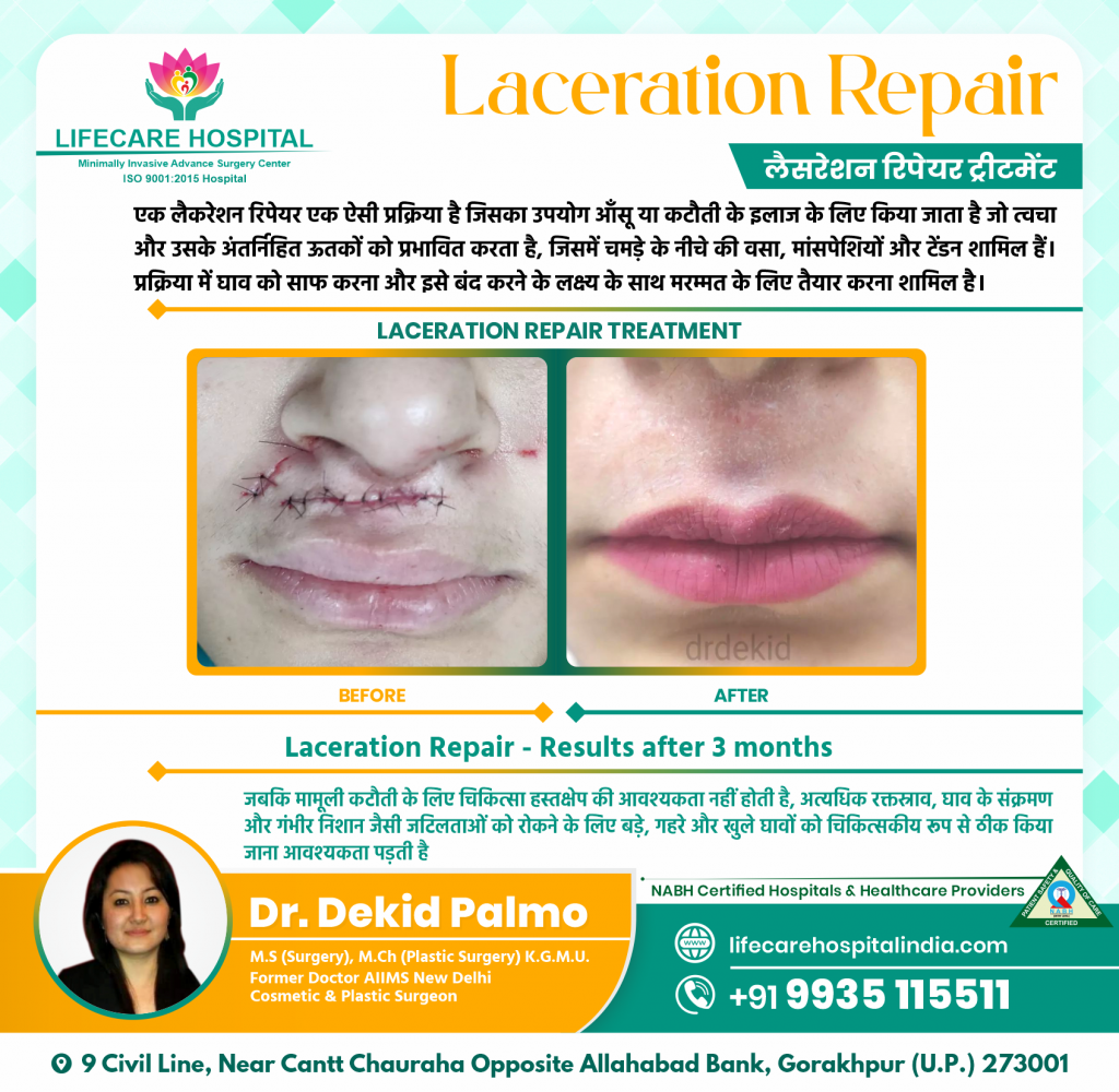 Laceration Repair - LIFECARE HOSPITAL