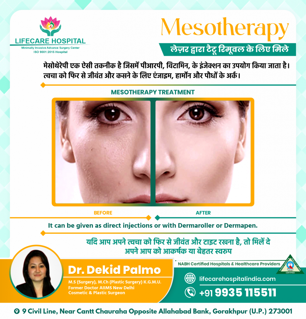 Mesotherapy - LIFECARE HOSPITAL