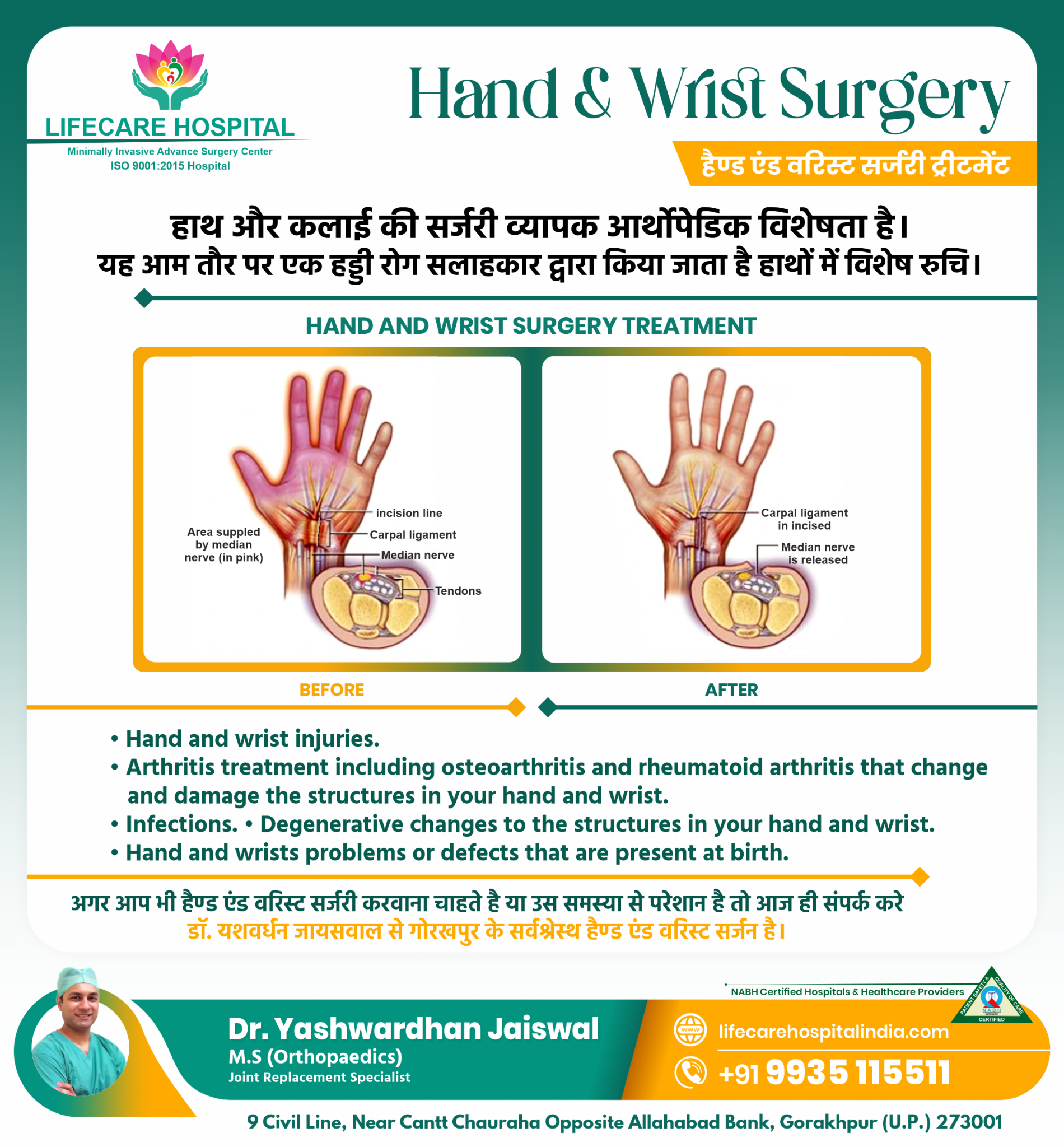 Hand & Wrist Surgery - LIFECARE HOSPITAL