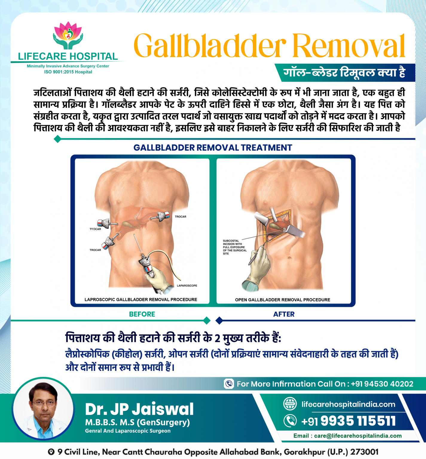Gallbladder Removal - LIFECARE HOSPITAL