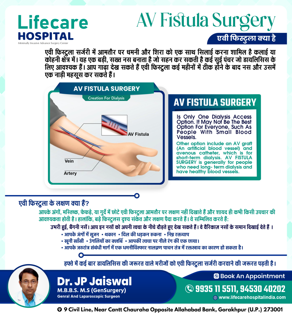 V Fistula Surgery - LIFECARE HOSPITAL